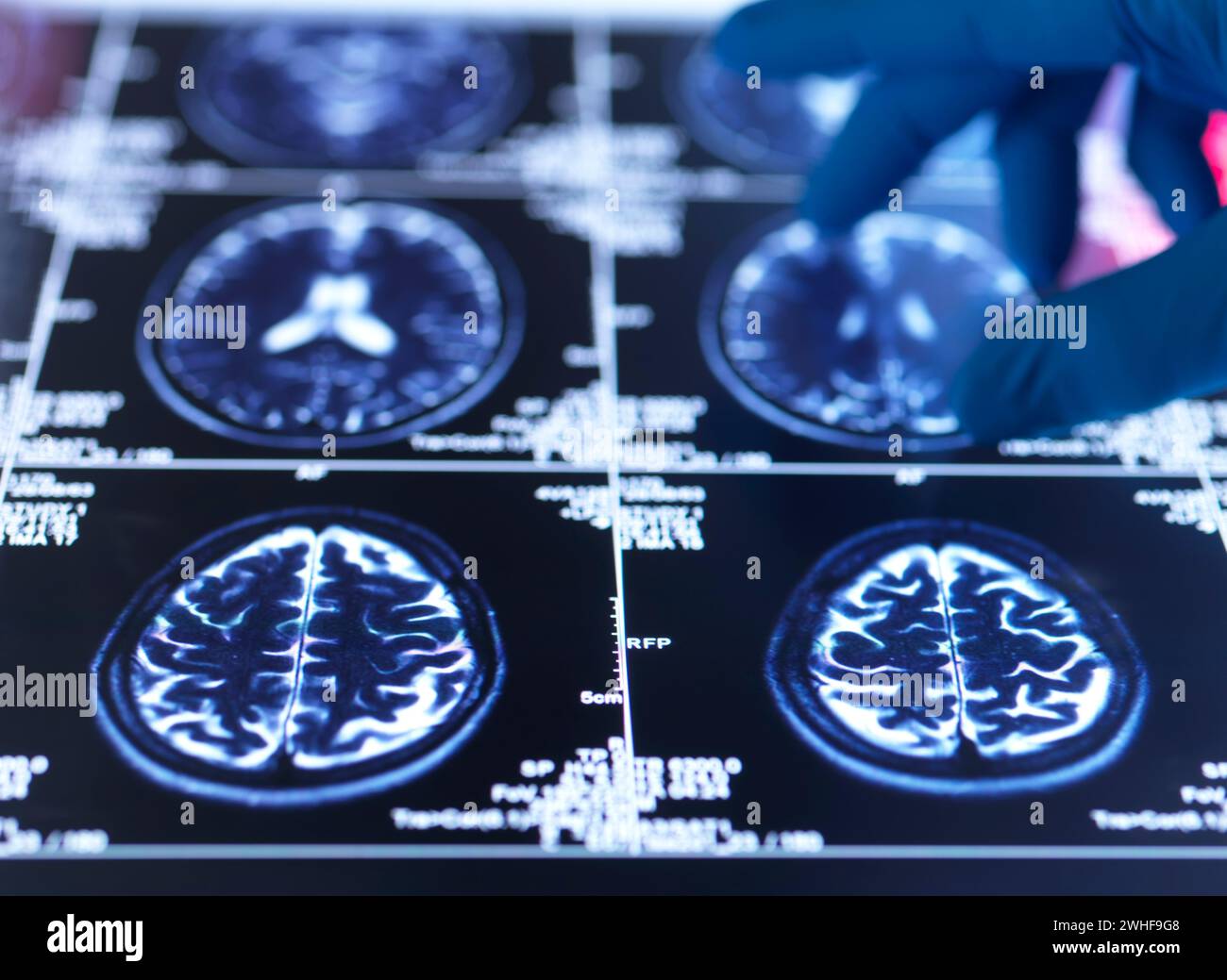 Medical research hi-res stock photography and images - Alamy