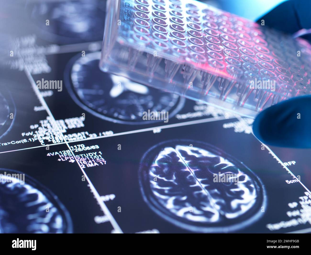 Brain research, conceptual image Stock Photo - Alamy