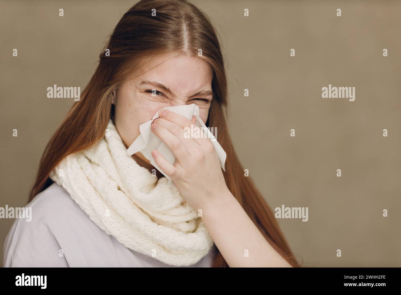 Young woman blowing nose has flu catarrh ill sick disease treatment ...