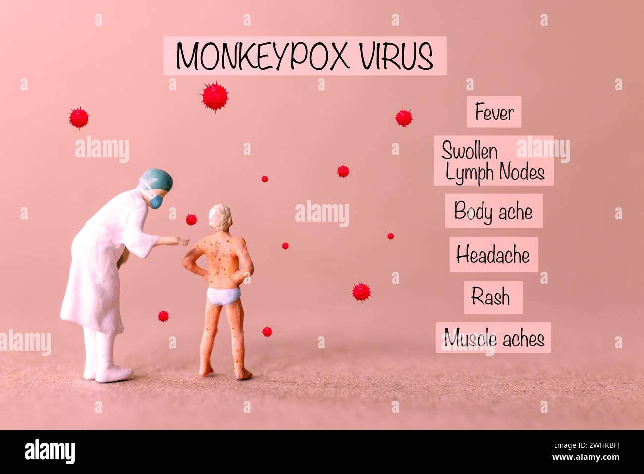 Miniature people Child with monkeypox. The boy is sick. Rash on the ...
