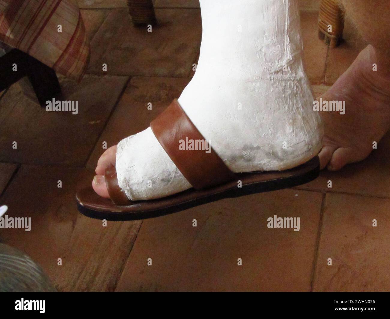 Injured foot in a cast after an accident Stock Photo - Alamy