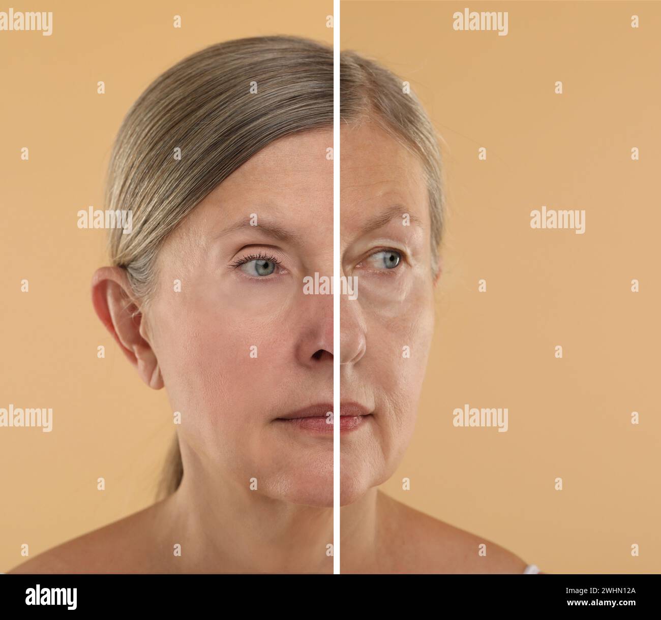 Aging skin changes. Woman showing face before and after rejuvenation ...