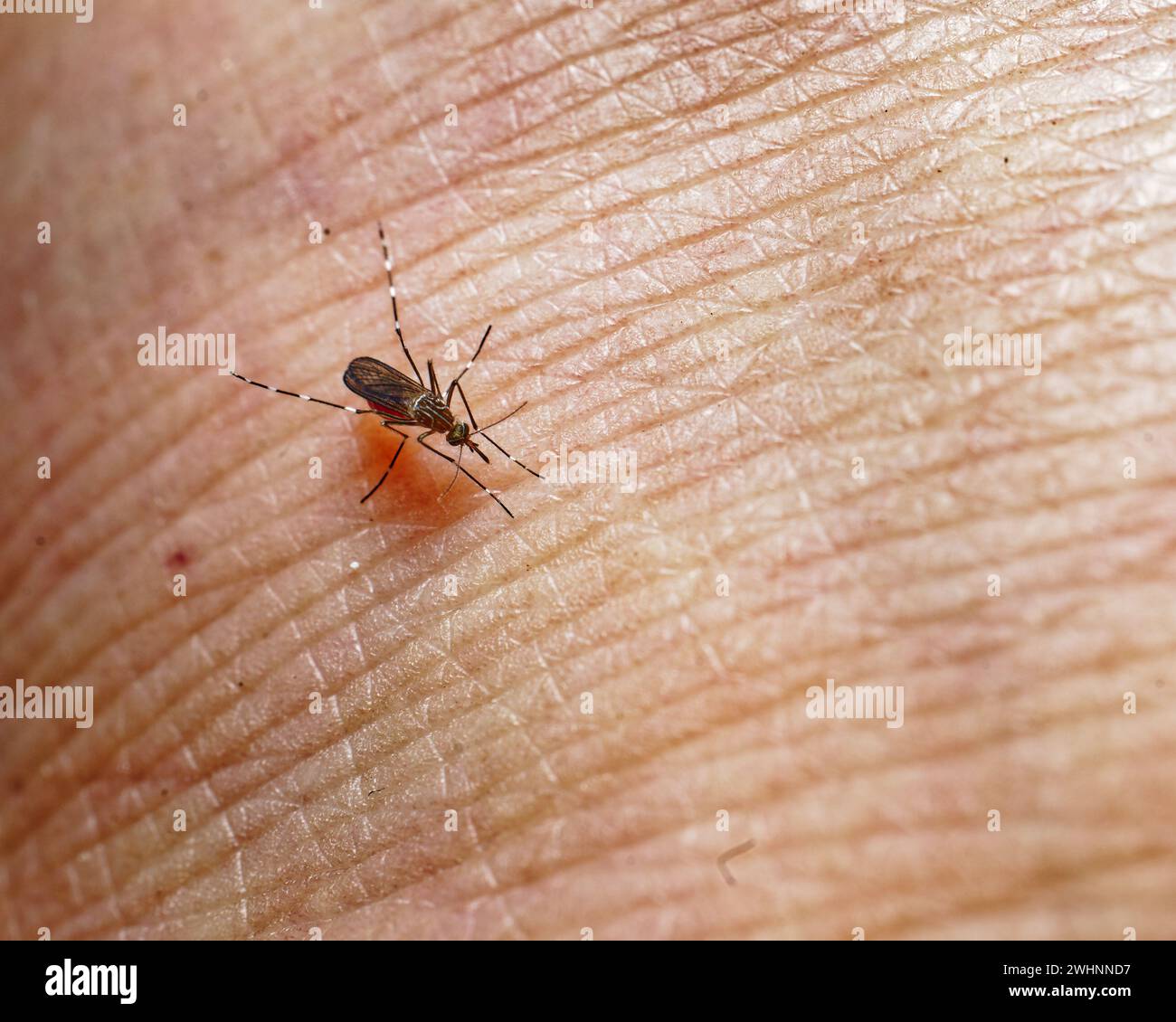Female Striped Mosquito feeding on blood on a human arm. South Island ...