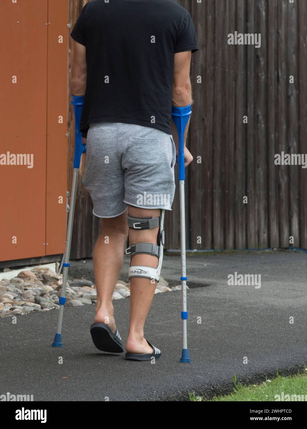Foot injury after an accident Stock Photo - Alamy