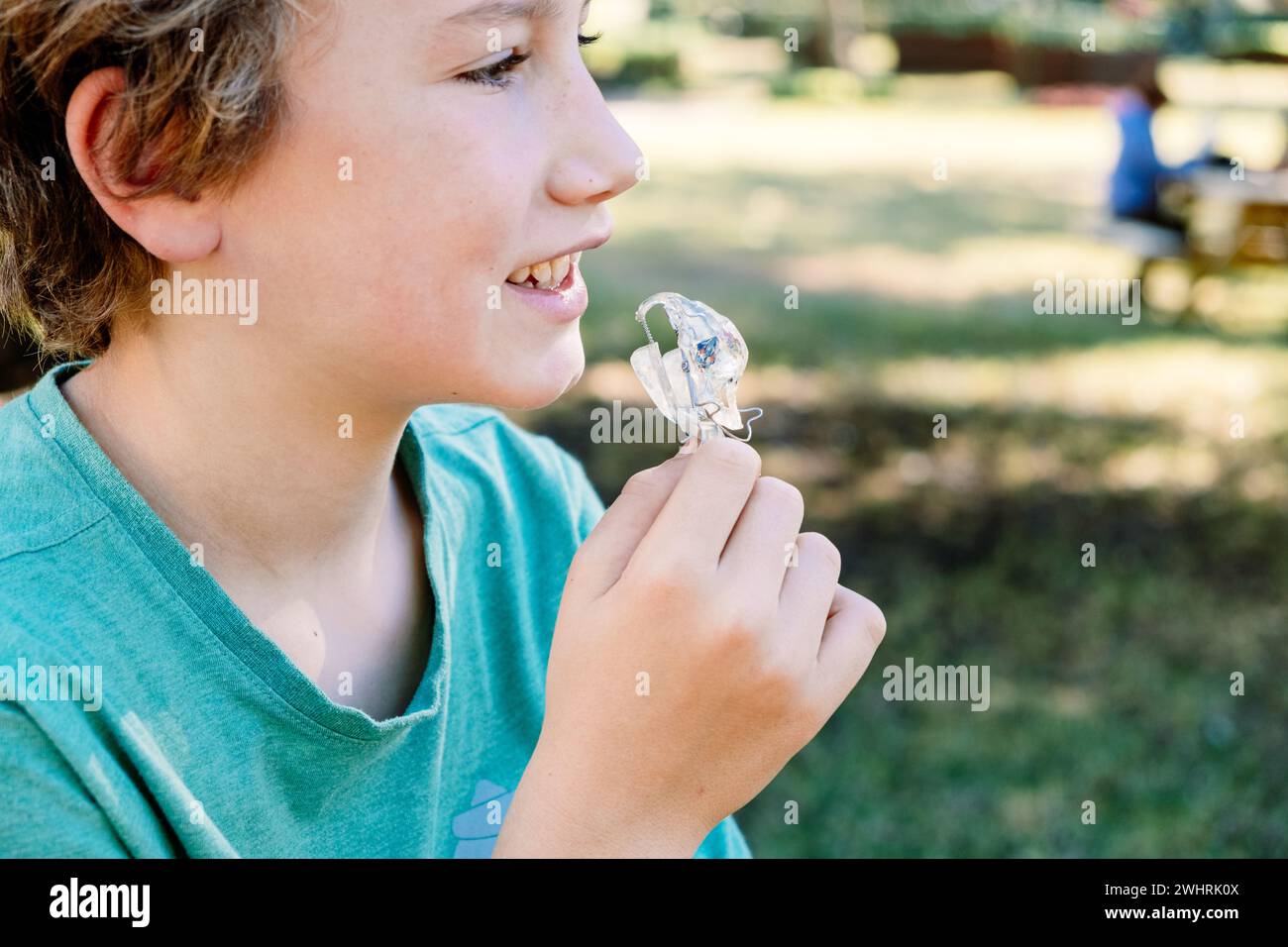Child with orthodontic appliance to correct malocclusion, forward bite ...