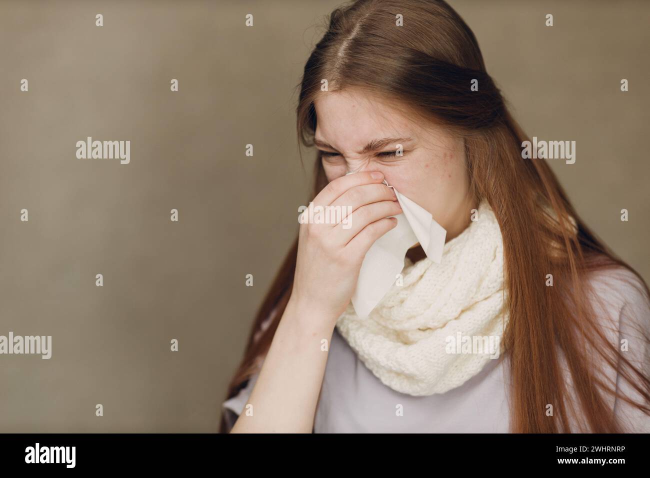 Young woman blowing nose has flu catarrh ill sick disease treatment ...