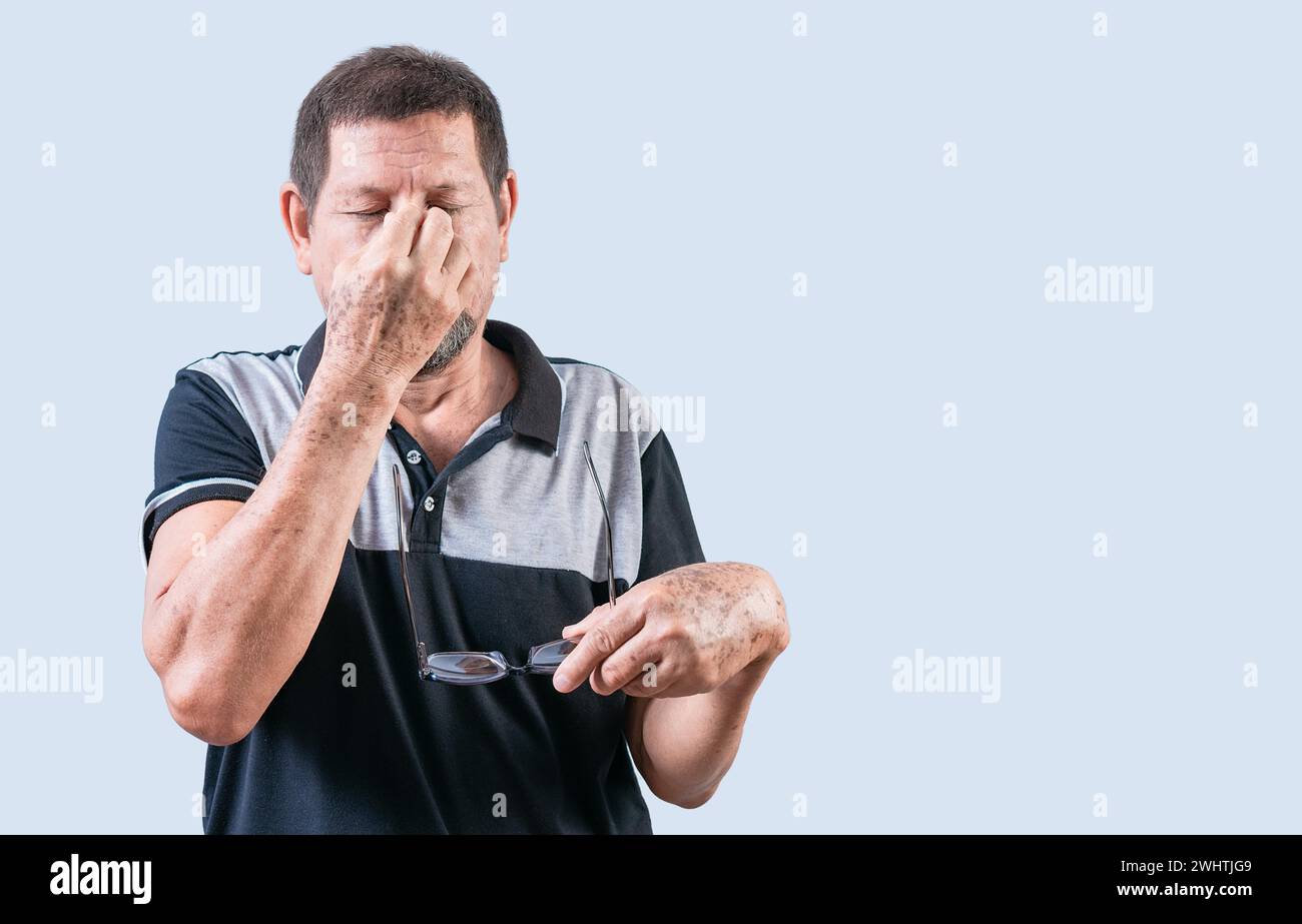 Senior man with eyestrain holding glasses isolated. Person with ...