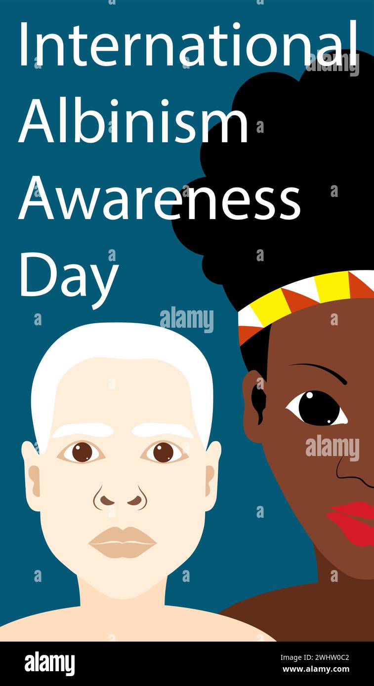 International Albinism Awareness Day. Albino boy next to an African ...