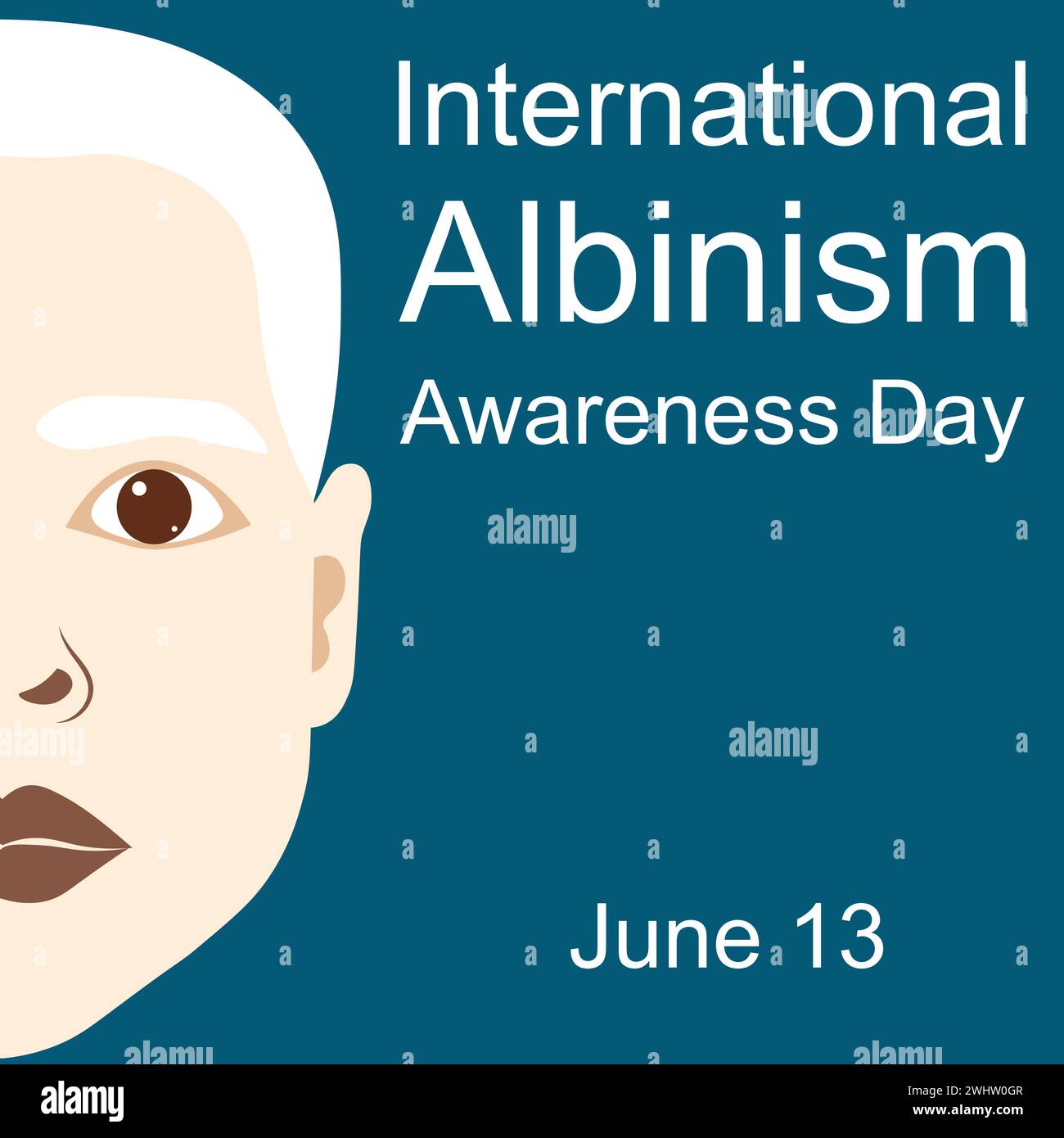 International Albinism Awareness Day. Albino boy. Genetic rare disorder ...