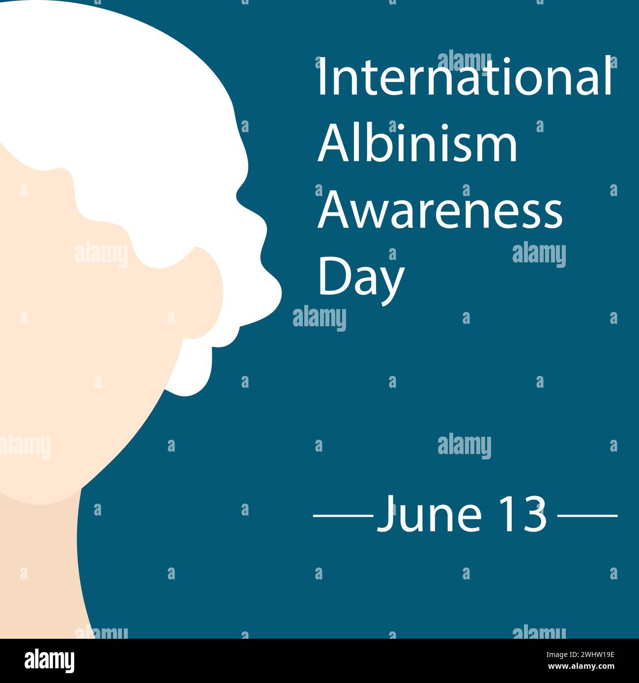 International Albinism Awareness Day. Girl with white wavy hair ...