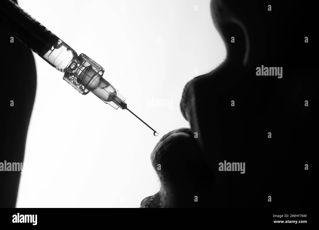 Procedure Of Lips Augmentation Syringe Female Mouth Hyaluronic Acid Injection Augmentation