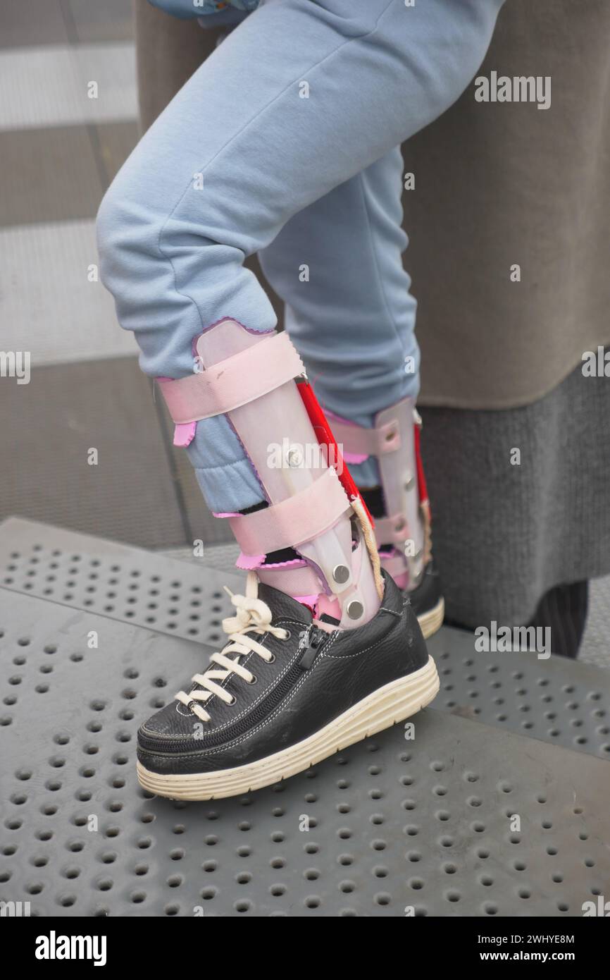 Child cerebral palsy disability, legs orthosis Stock Photo - Alamy