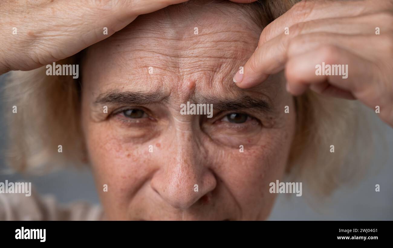 Unhappy elderly woman pointing at wrinkles on her forehead Stock Photo ...