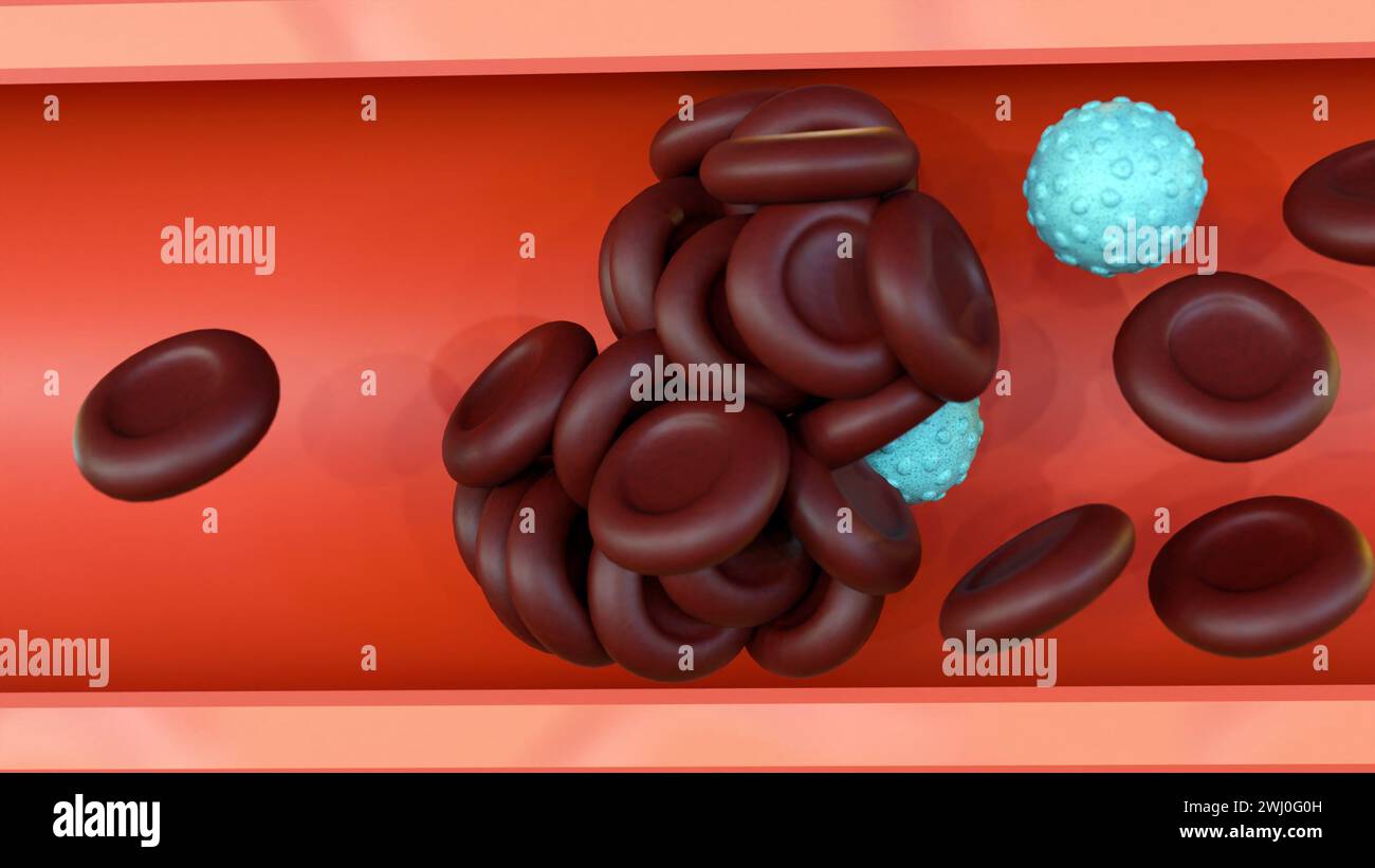 3d rendering of agglutination or hemagglutination, is an immune ...
