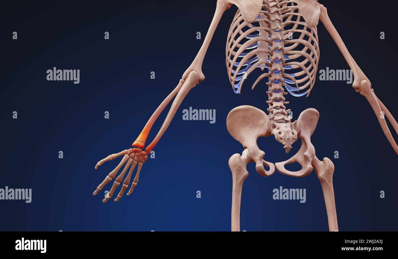 3d rendered illustration of a human skeleton with wrist pain Stock ...