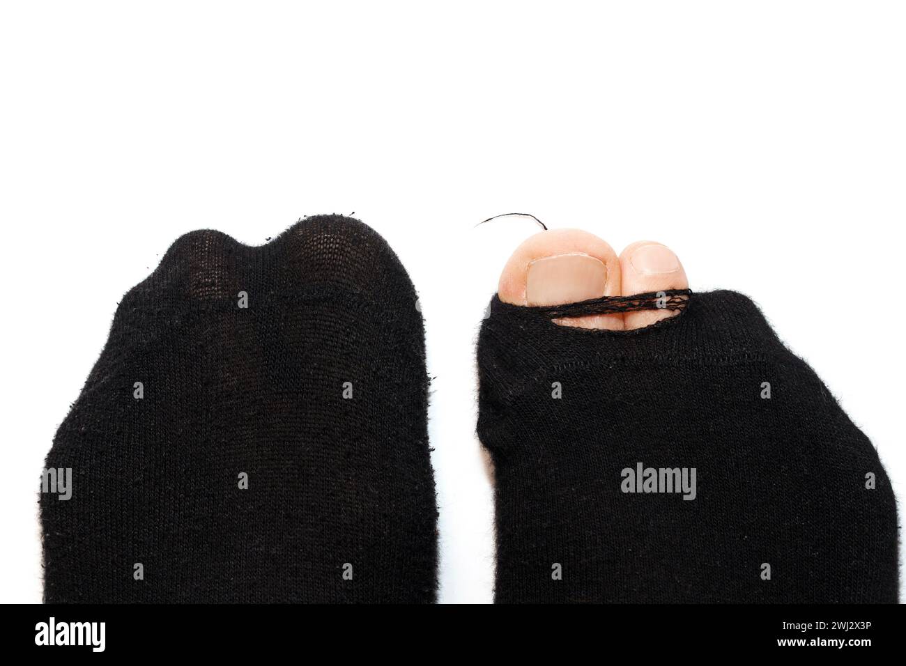 Closeup shot of male feet in hoaly socks with sticking out toe Stock ...