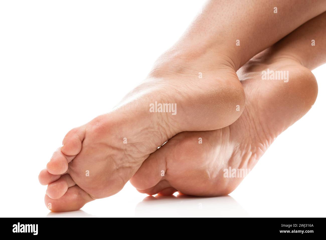 Female heels with dead skin against white background Stock Photo - Alamy