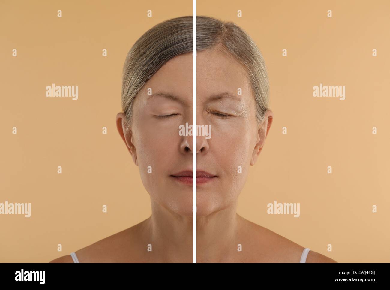 Aging skin changes. Woman showing face before and after rejuvenation ...