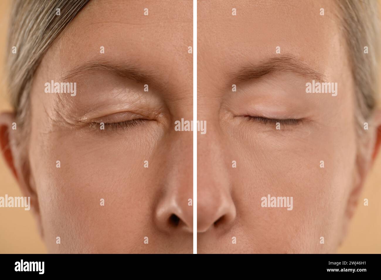 Aging skin changes. Woman showing face before and after rejuvenation ...