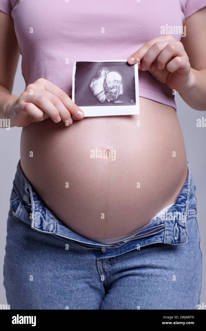 Human embryo ultrasound hi-res stock photography and images - Alamy