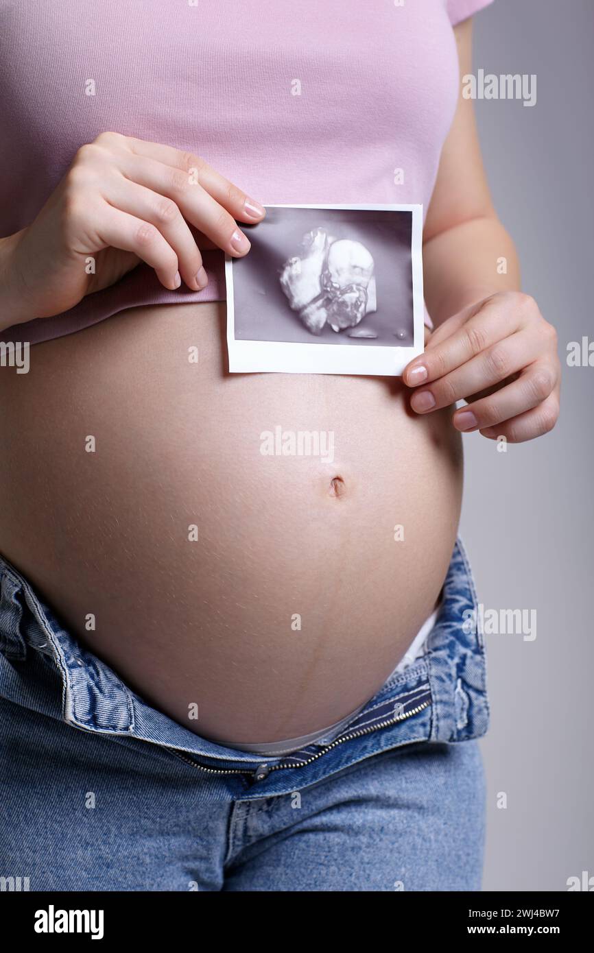 Human embryo ultrasound hi-res stock photography and images - Alamy