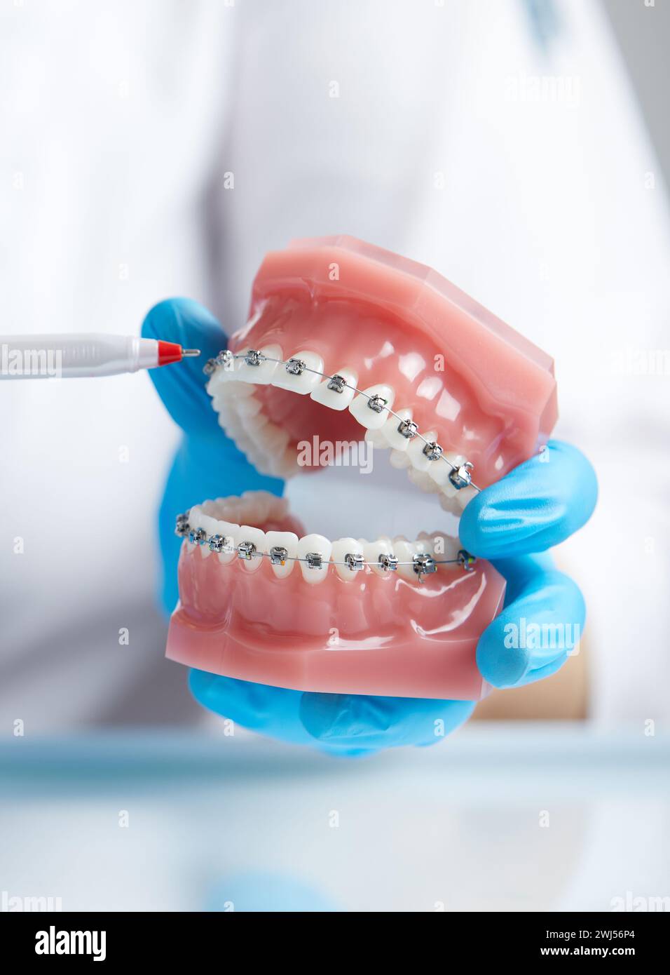 Doctor orthodontist showing model of human jaw with wire braces ...