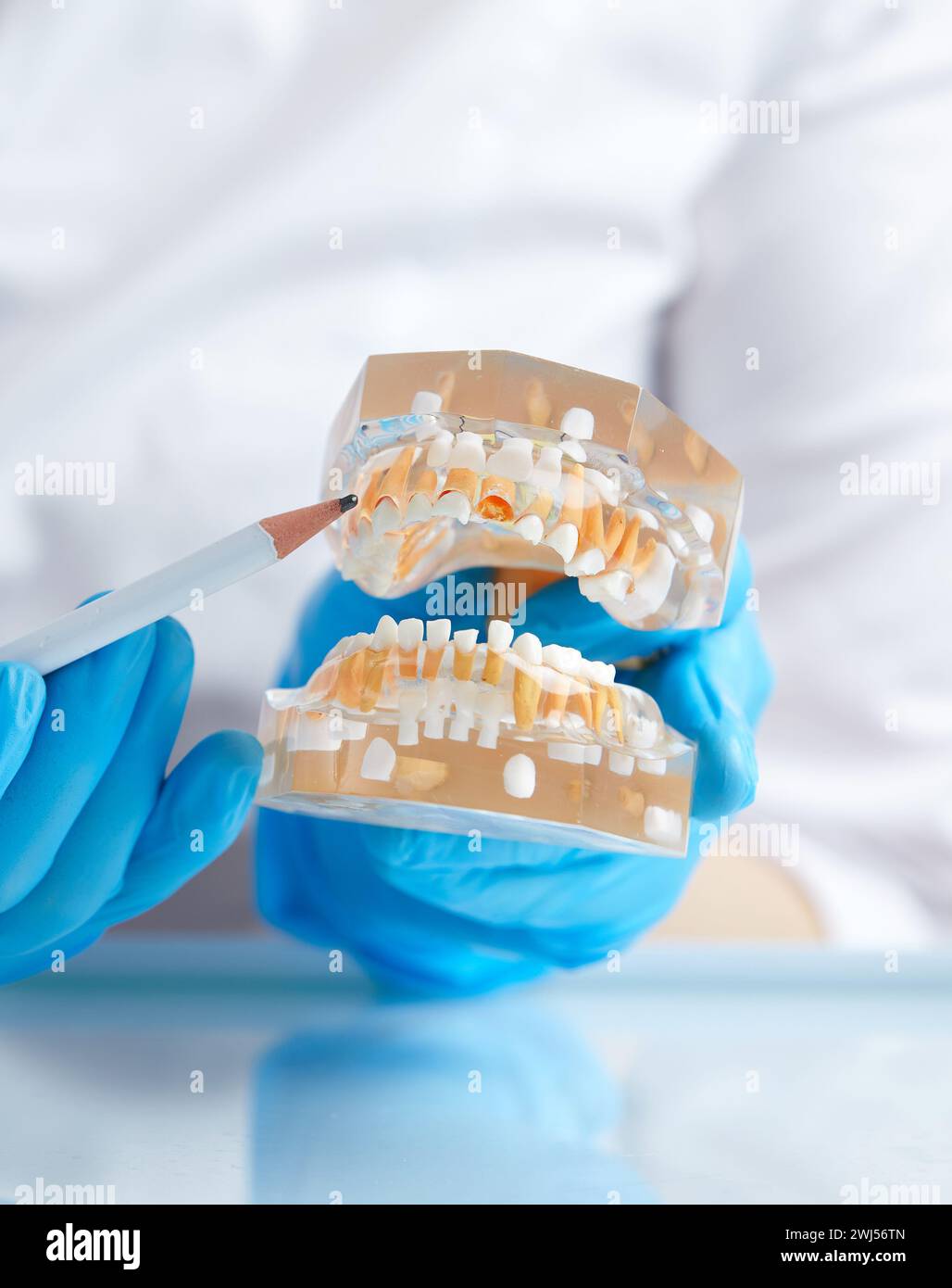 Dental teeth 3d transparent model of jaw Stock Photo - Alamy