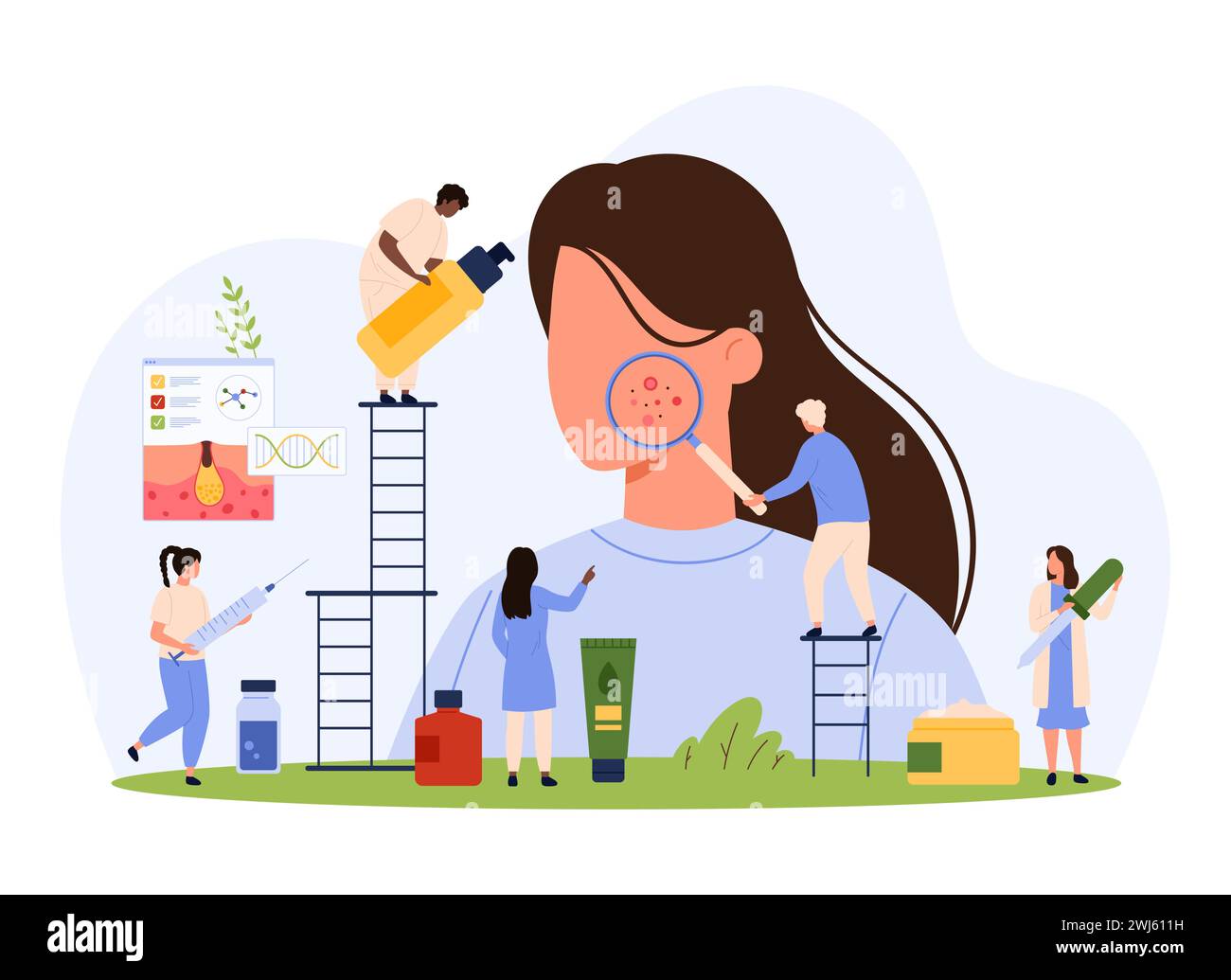 Psoriasis cartoon hi-res stock photography and images - Alamy