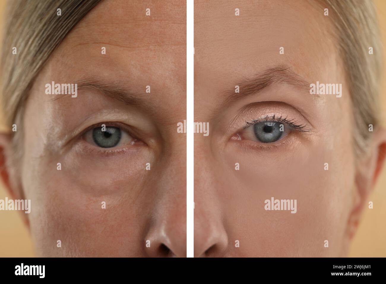 Aging skin changes. Woman showing face before and after rejuvenation ...