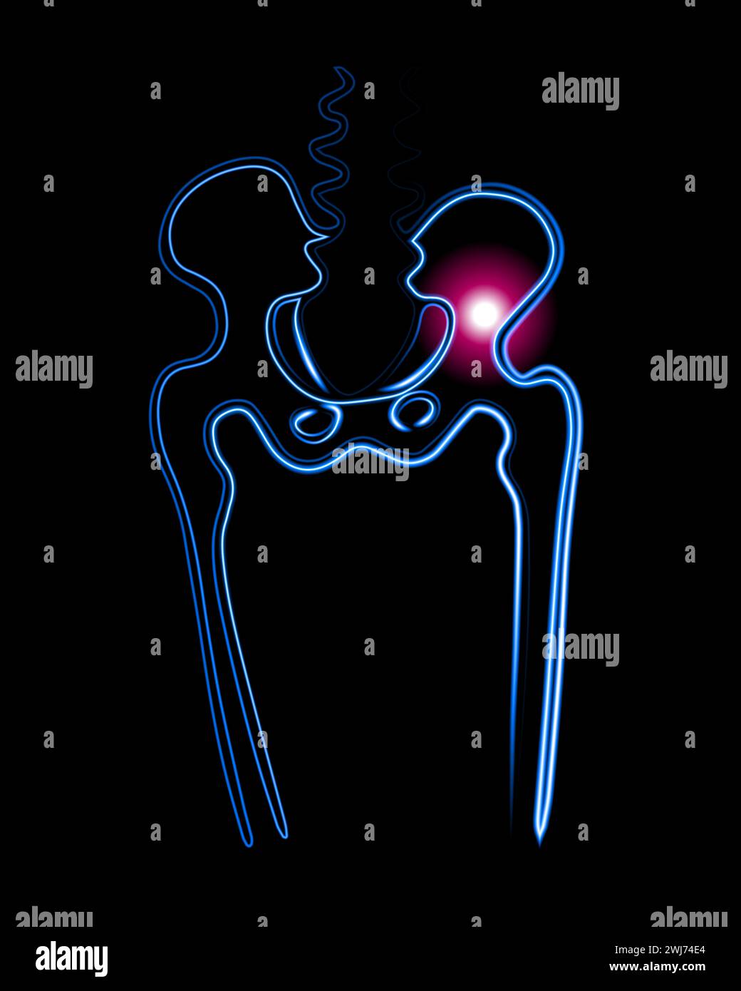 Vector isolated illustration of pelvic bone injury. Pelvic fracture. Pain in the pelvic bone ...