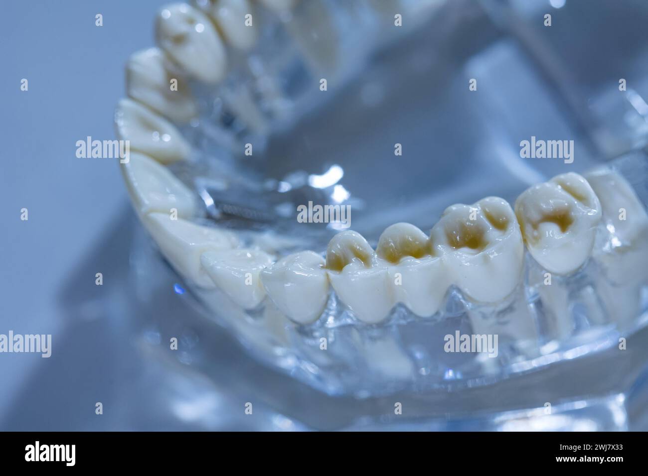 Teeth education model. Shallow dof Stock Photo - Alamy