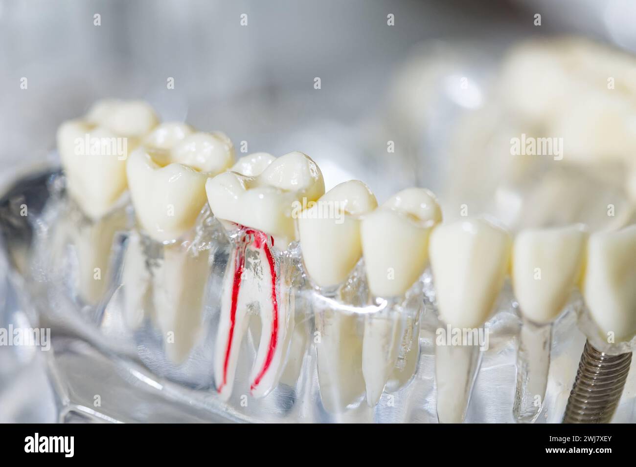 Teeth education model. Shallow dof Stock Photo - Alamy