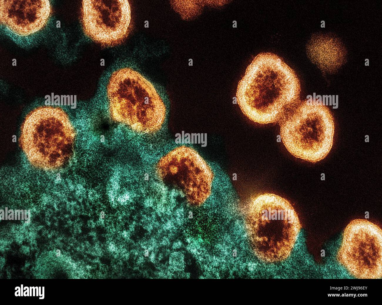 HIV-1 virus particles, TEM Stock Photo - Alamy