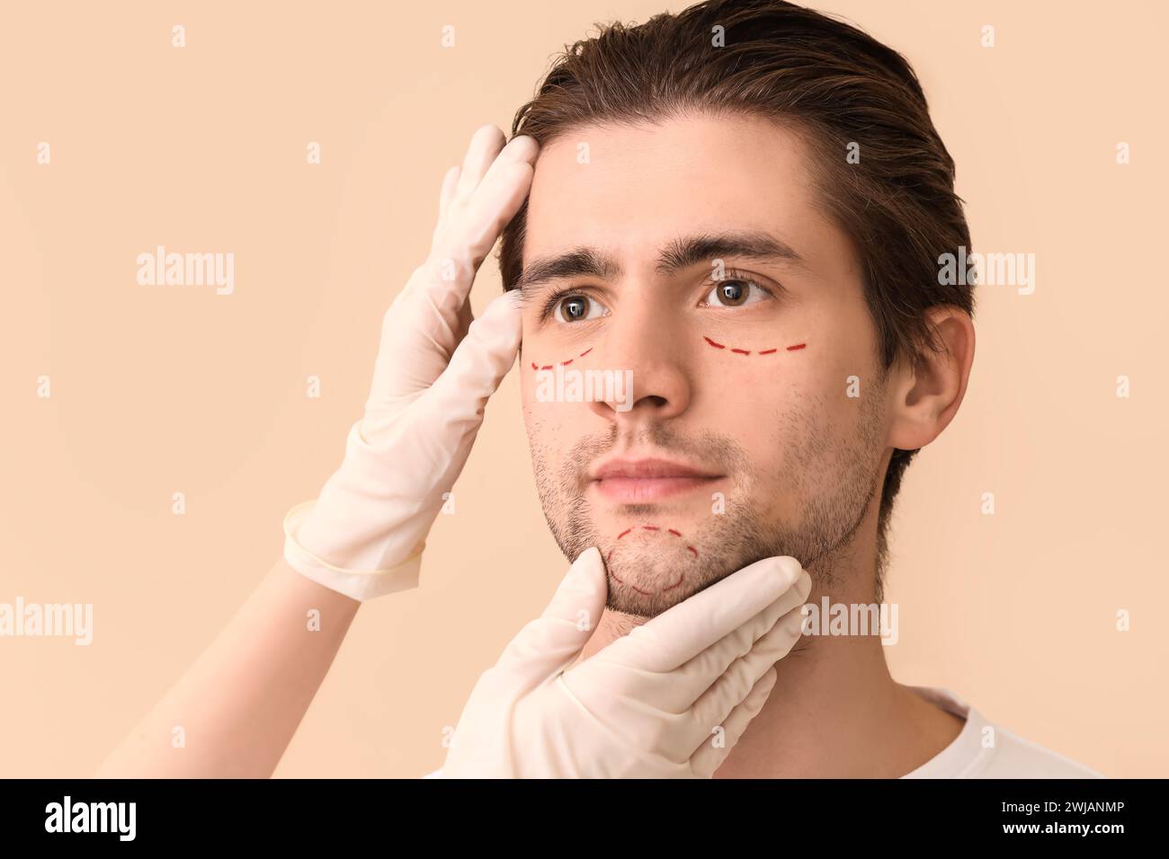 Plastic surgeon and young man with marked face on beige background ...