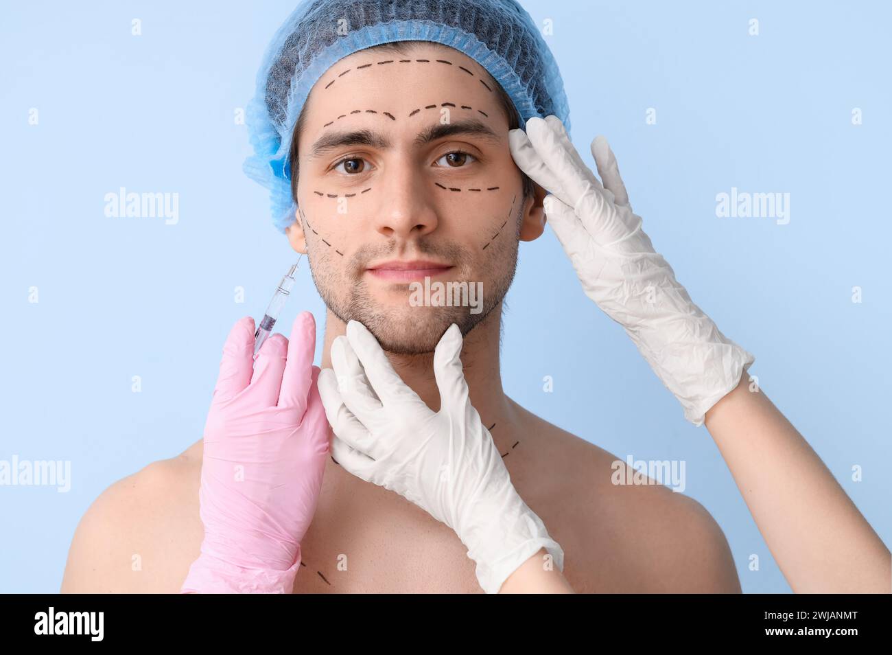 Plastic surgeons with syringe and young man with marked face against blue background, closeup ...