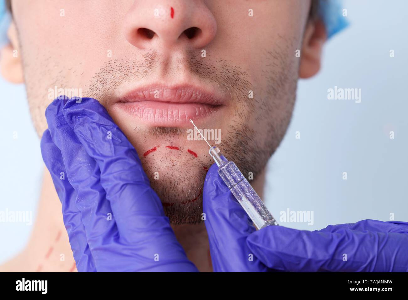 Young man with marked face receiving injection on blue background ...