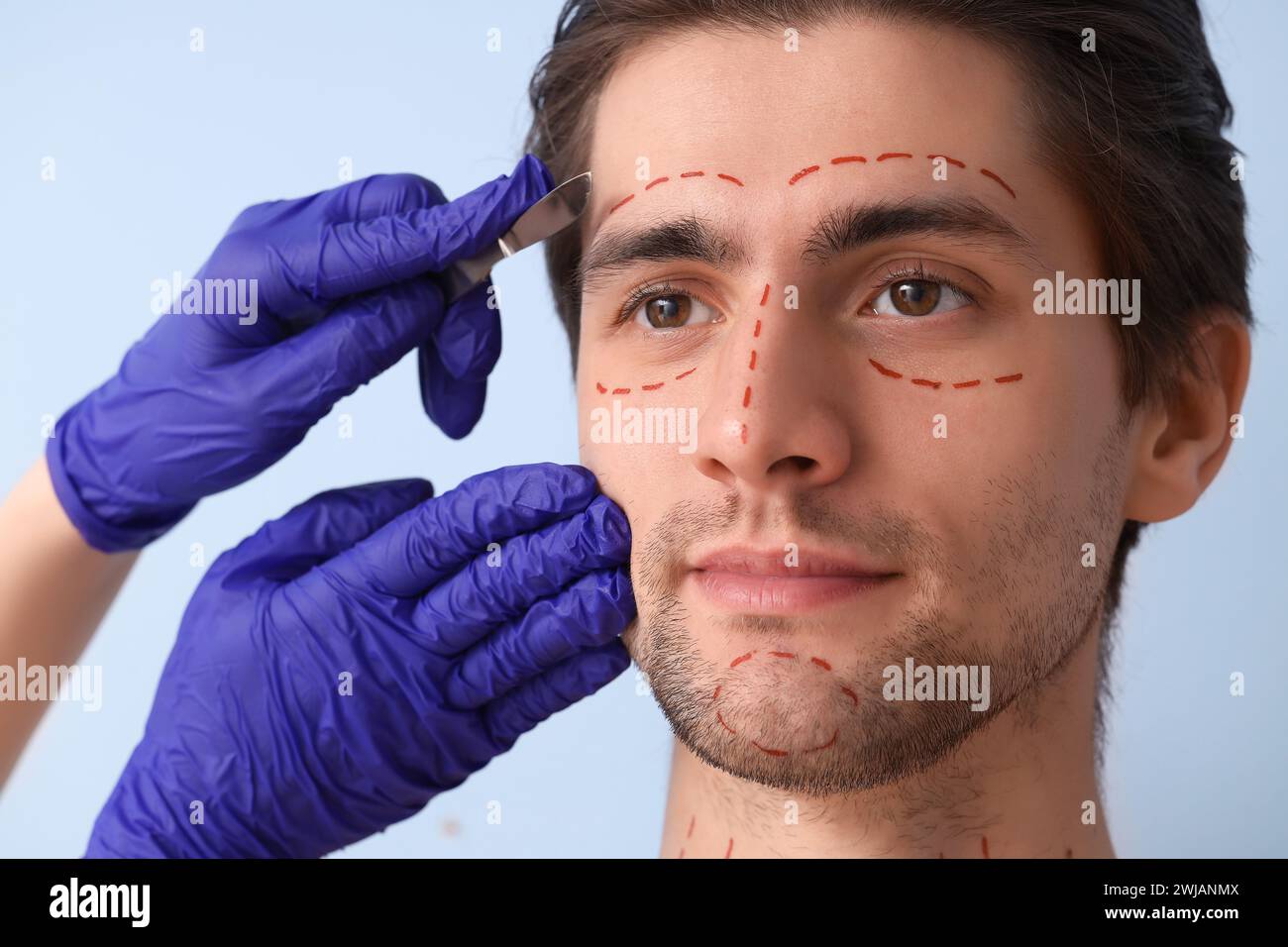 Plastic surgeon with scalpel and markings on young man's face against ...