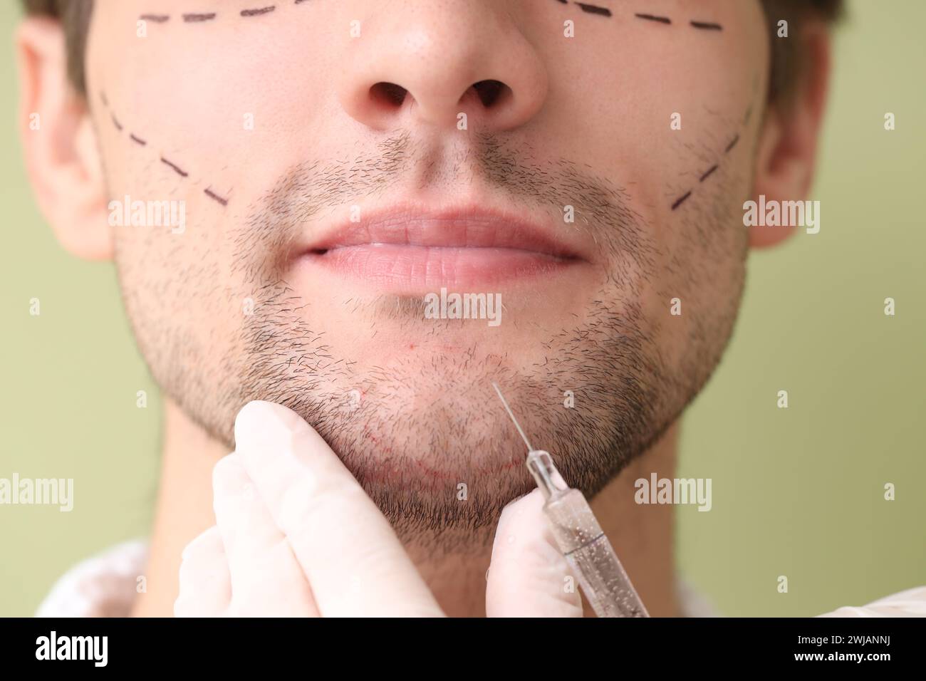 Young man with marked face receiving injection on green background ...