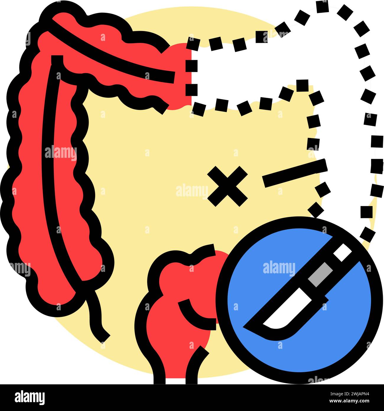 bowel resection surgery doctor color icon vector illustration Stock ...