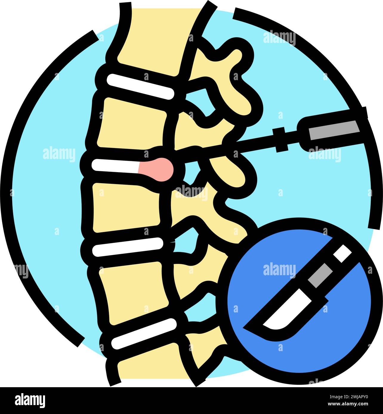 Discectomy hi-res stock photography and images - Alamy