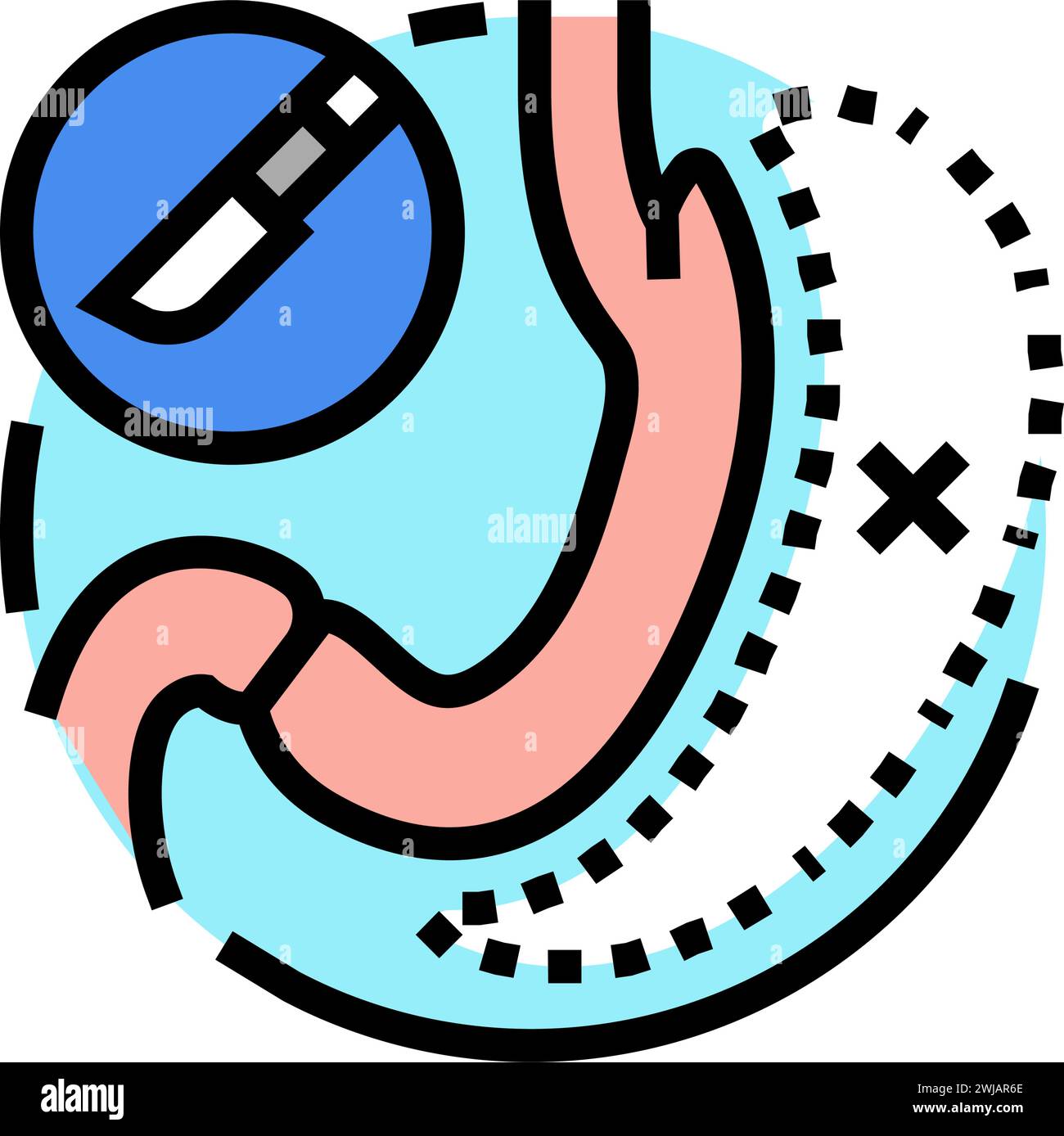 gastrectomy surgery doctor color icon vector illustration Stock Vector ...