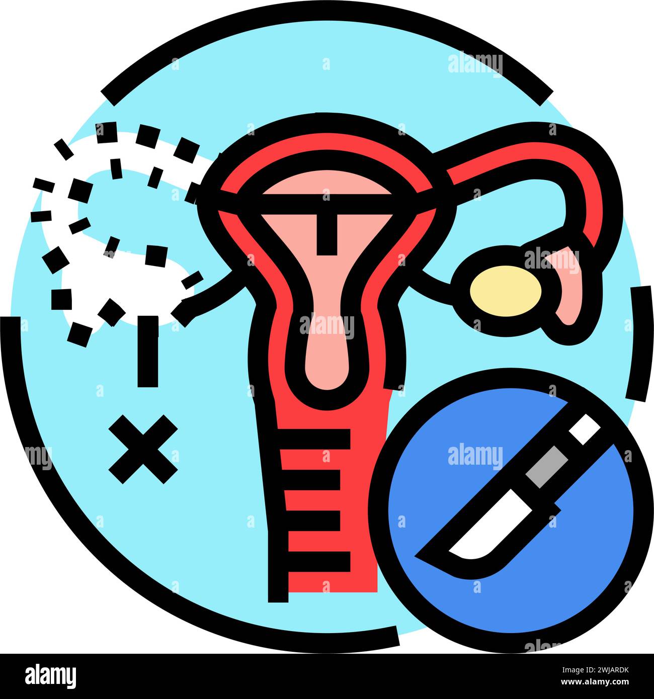 oophorectomy surgery hospital color icon vector illustration Stock ...