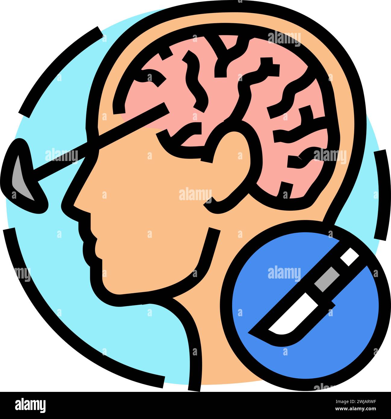 Lobotomy procedure hi-res stock photography and images - Alamy