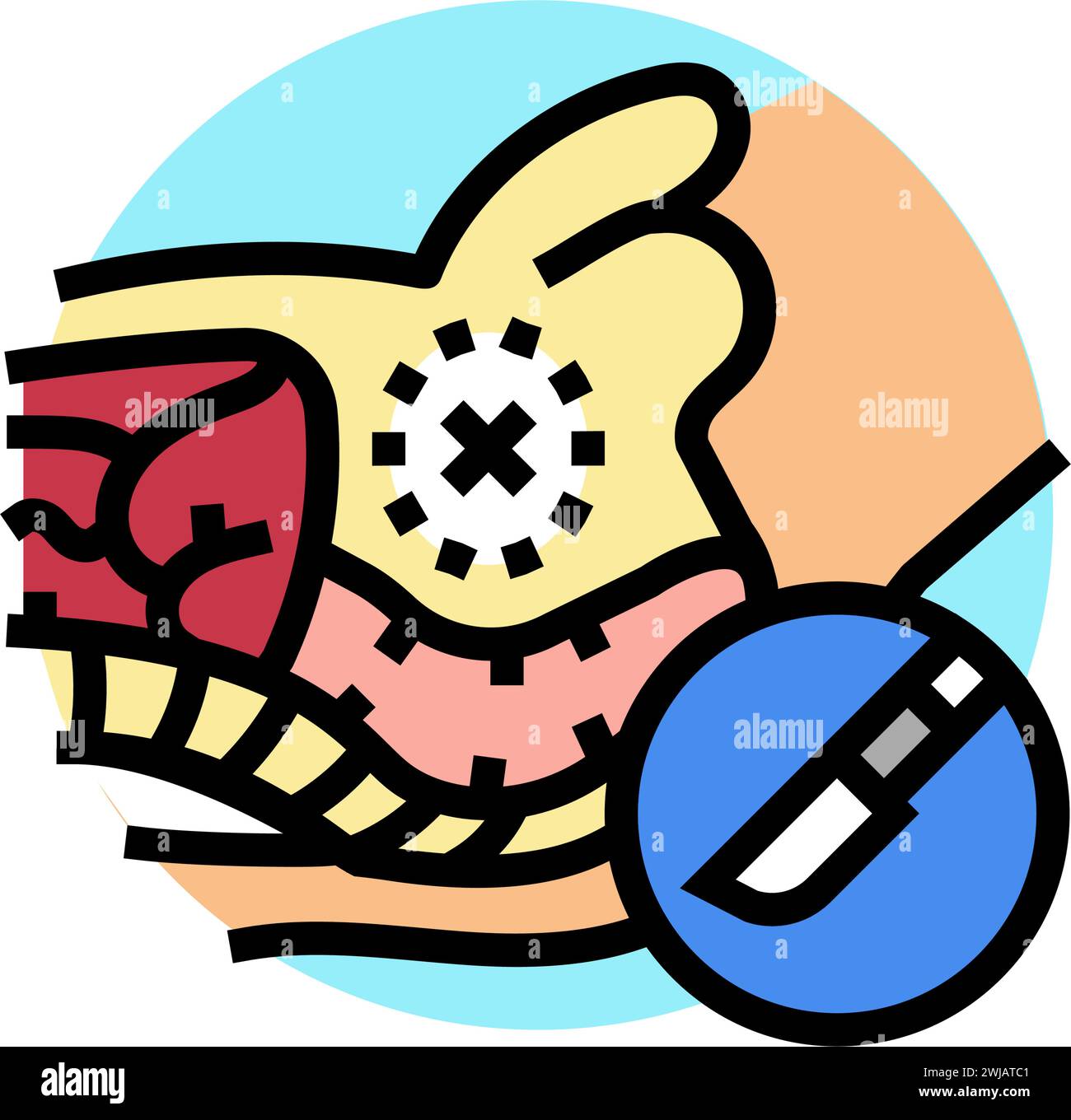 prostatectomy surgery hospital color icon vector illustration Stock ...