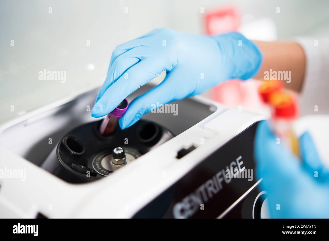 A sample tube with blood tests is placed in a centrifuge with a hand in ...