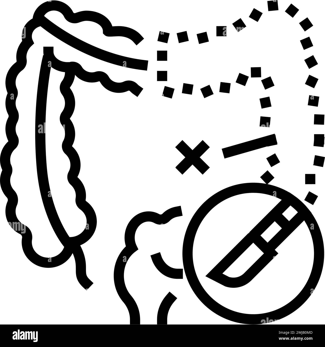 bowel resection surgery doctor line icon vector illustration Stock ...