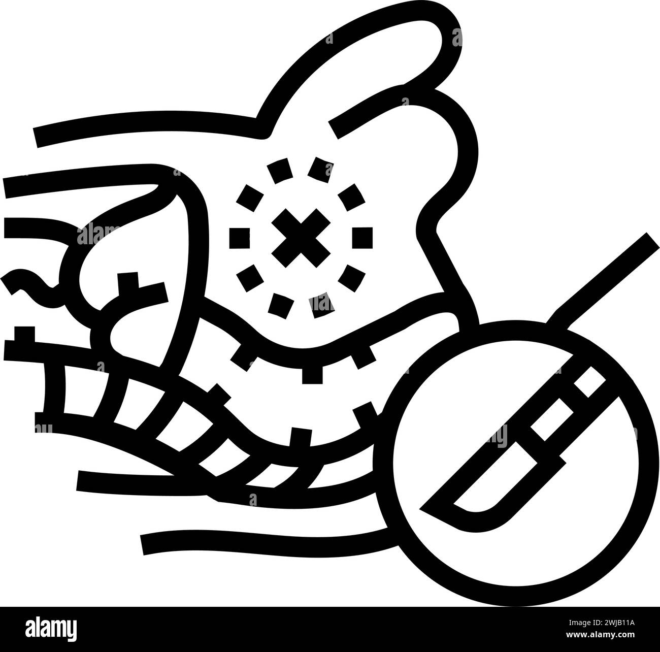 Prostatectomy Stock Vector Images - Alamy