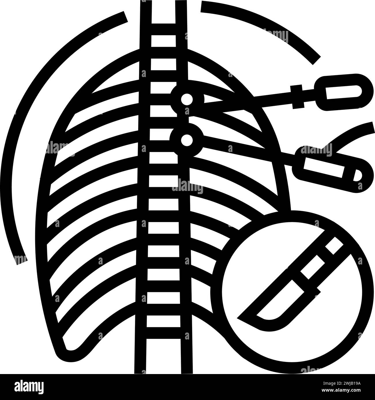 Endoscopy nose Black and White Stock Photos & Images - Alamy