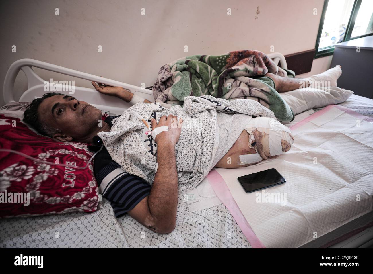 November 23, 2023: A Palestinian man lies in a bed with an amputated ...
