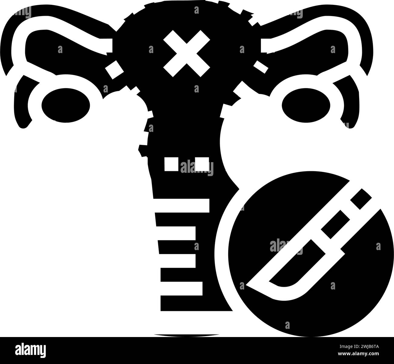 Hysterectomy procedure hi-res stock photography and images - Alamy